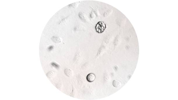 Fruchtbarkeits-Startup Ovascience wechselt erneut CEO aus und ...